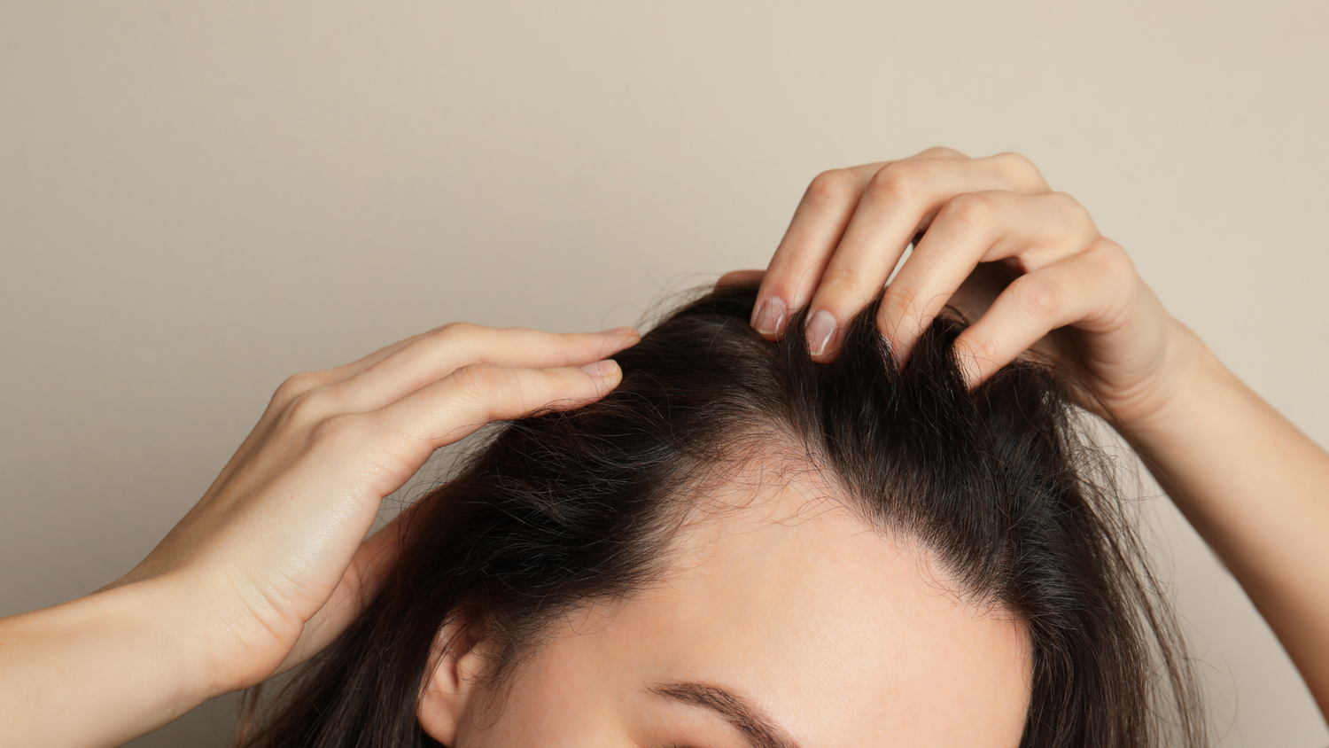 Dealing with Women's Hair Thinning: Tips and Solutions – Dr Yates MD