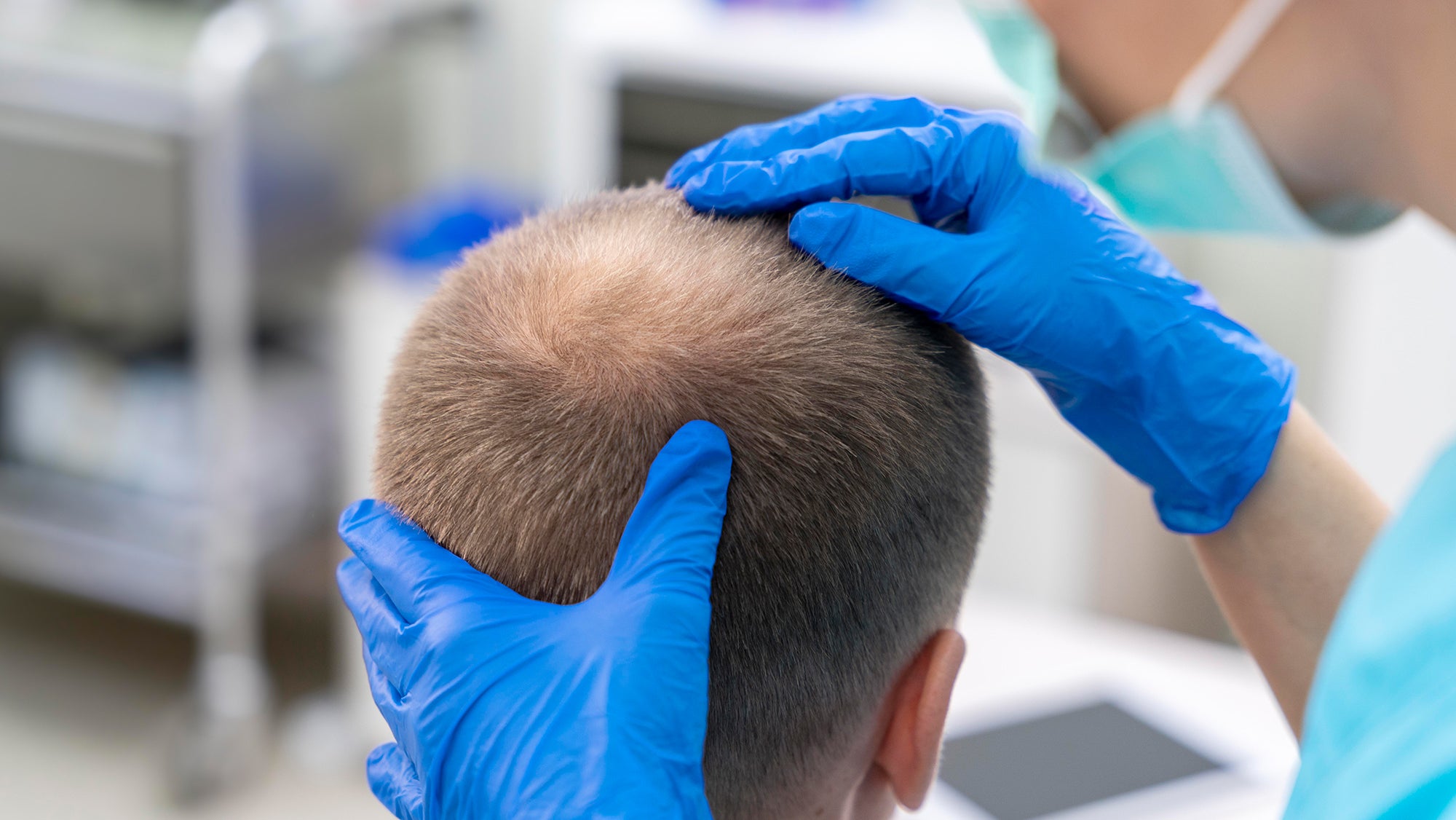 The Science Behind Hair Fibers for Men and How They Work – Dr Yates MD