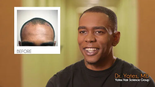 Fue Gallery – Dr Yates MD